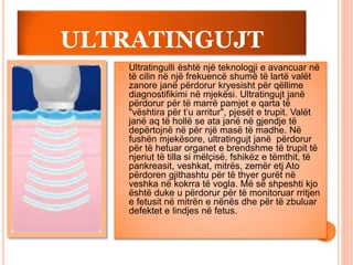 ZBATIMET E VALEVE | PPTX