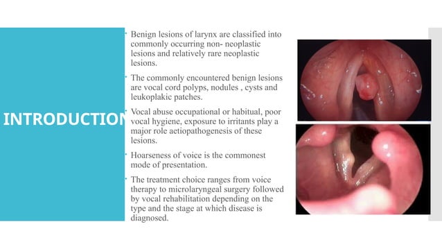 Benign lesions of larynx in ENT.ppt.pptx