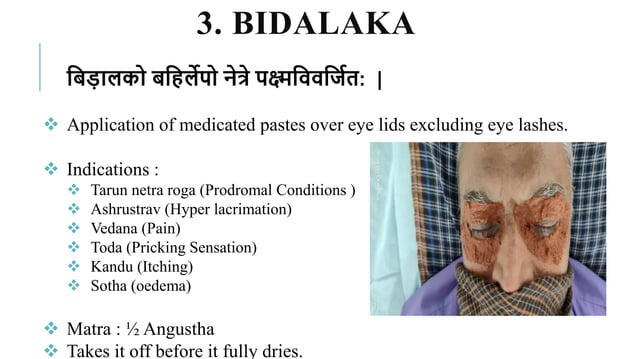 KRIYA KALPA - SHALAKYA TANTRA.pptx | Eye and Vision Conditions ...