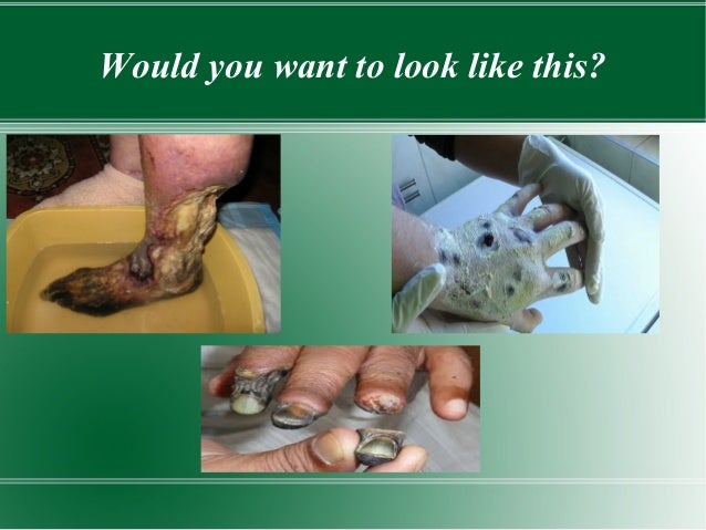 Krokodil slide