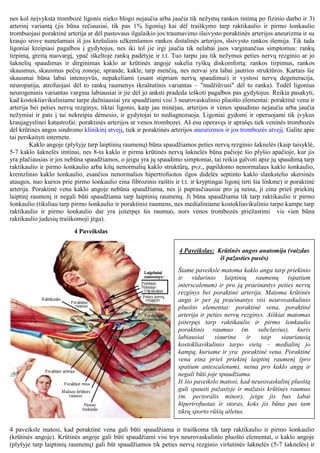 Krūtinės angos sindromas: anatomija, simptomatika, diagnostika ir ...
