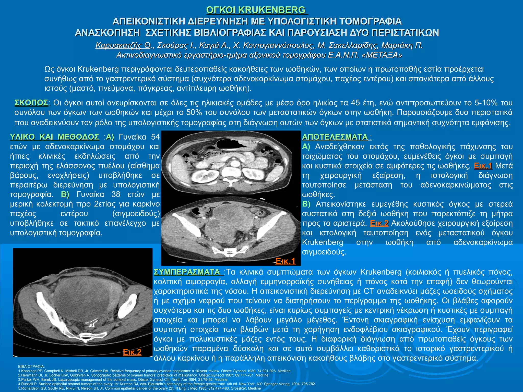 Krukenberg tumor | PPT