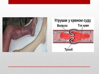 Krv - Jovana Bosnjakovic | PPTX