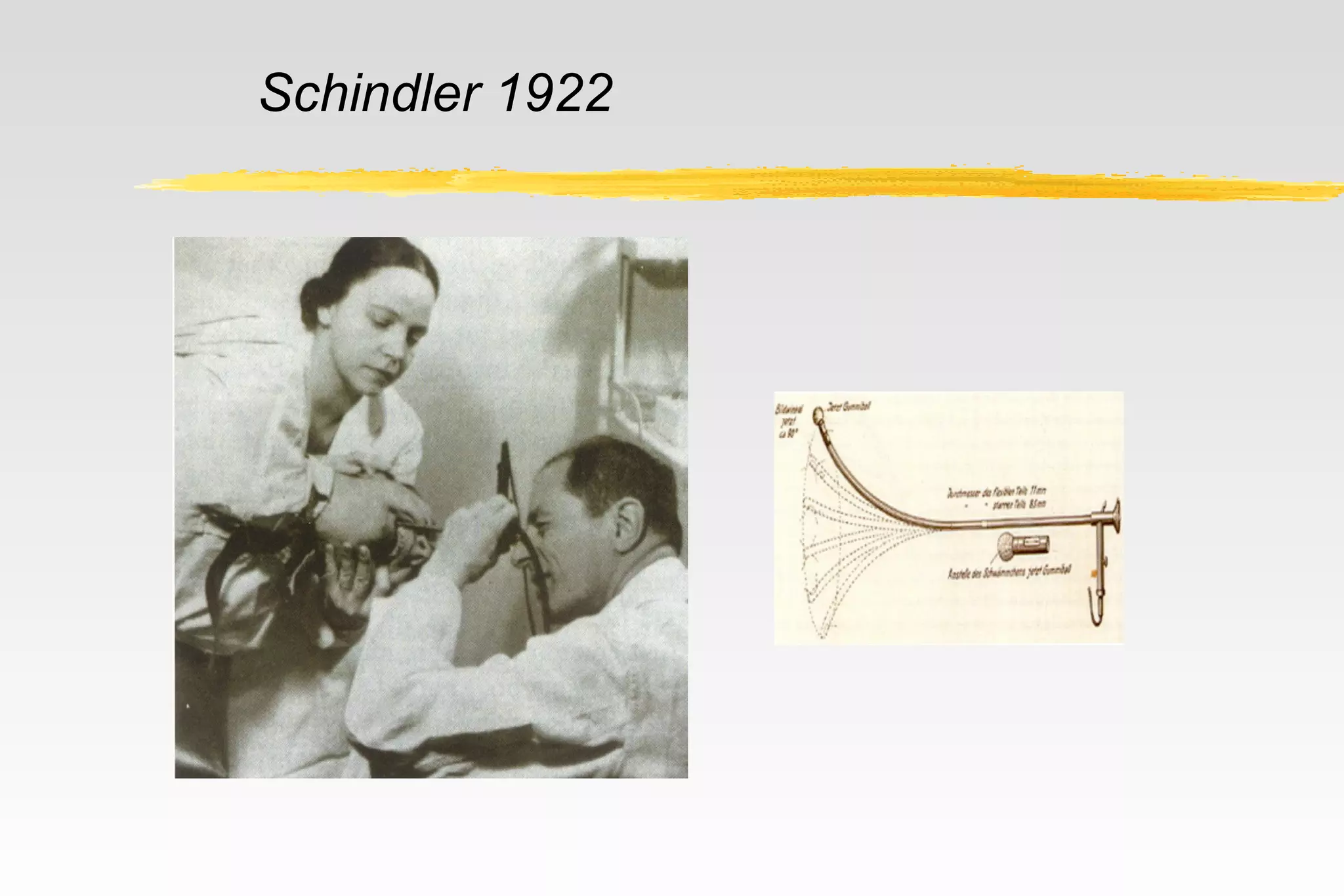 Krvavitve Iz Zgornjih Prebavil | PPT