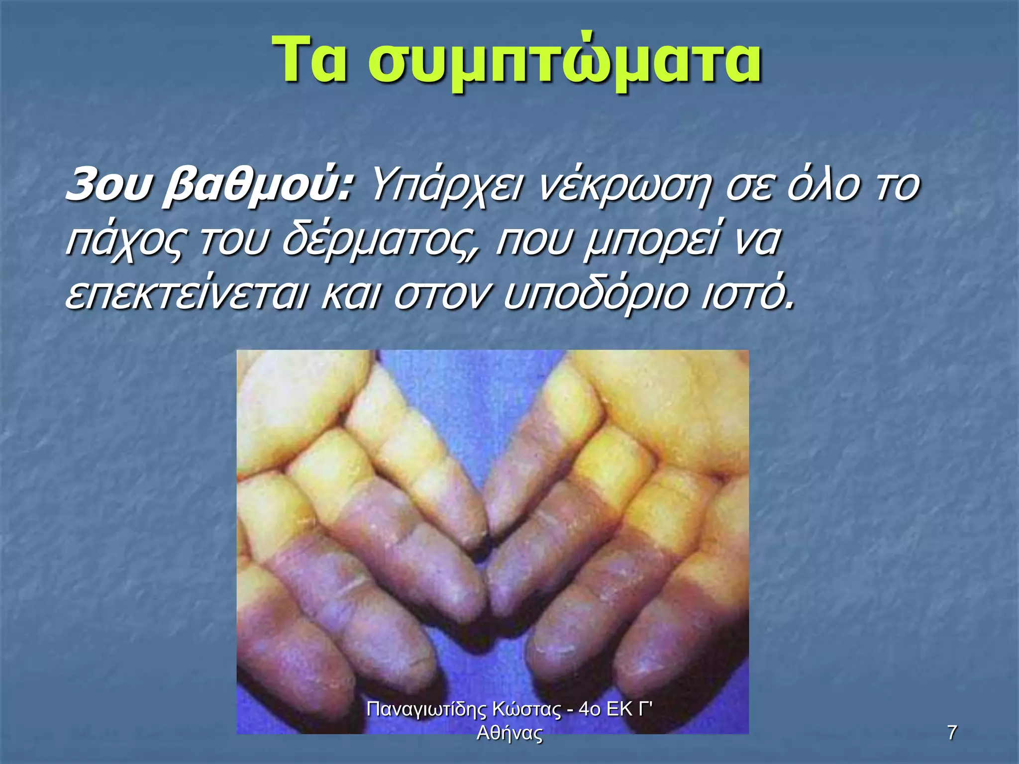 ΚΡΥΟΠΑΓΗΜΑΤΑ | PPTX