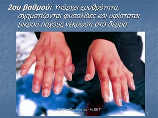 ΚΡΥΟΠΑΓΗΜΑΤΑ | PPTX