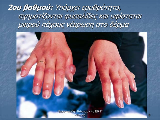 ΚΡΥΟΠΑΓΗΜΑΤΑ | PPT
