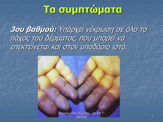 ΚΡΥΟΠΑΓΗΜΑΤΑ | PPT