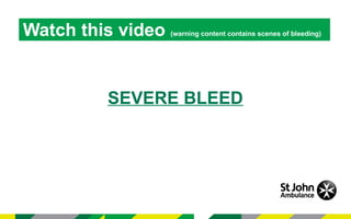 ks4-bleeding.pptx first aid how to manage injuries | PPTX