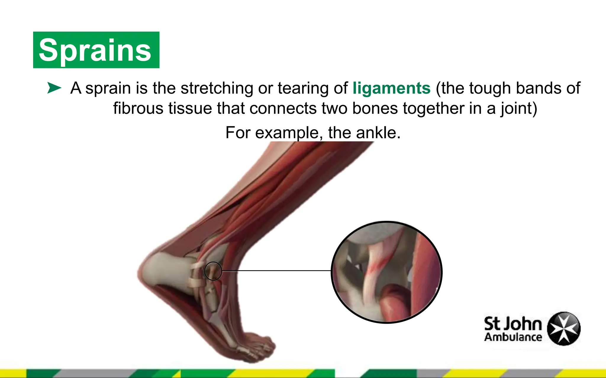 ks4-bone-muscle-and-joint-injuries.pptxx | PPTX
