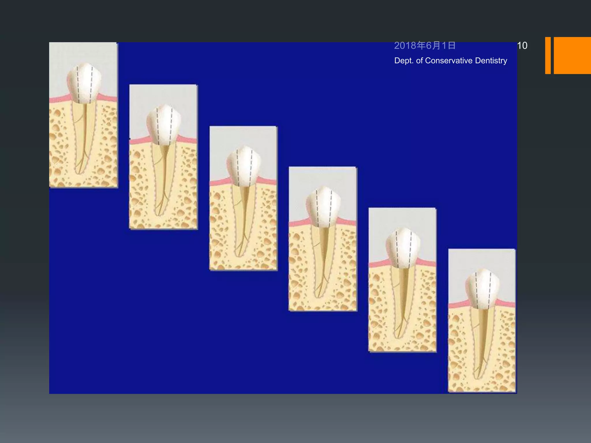Access Cavity Prepration | PPTX