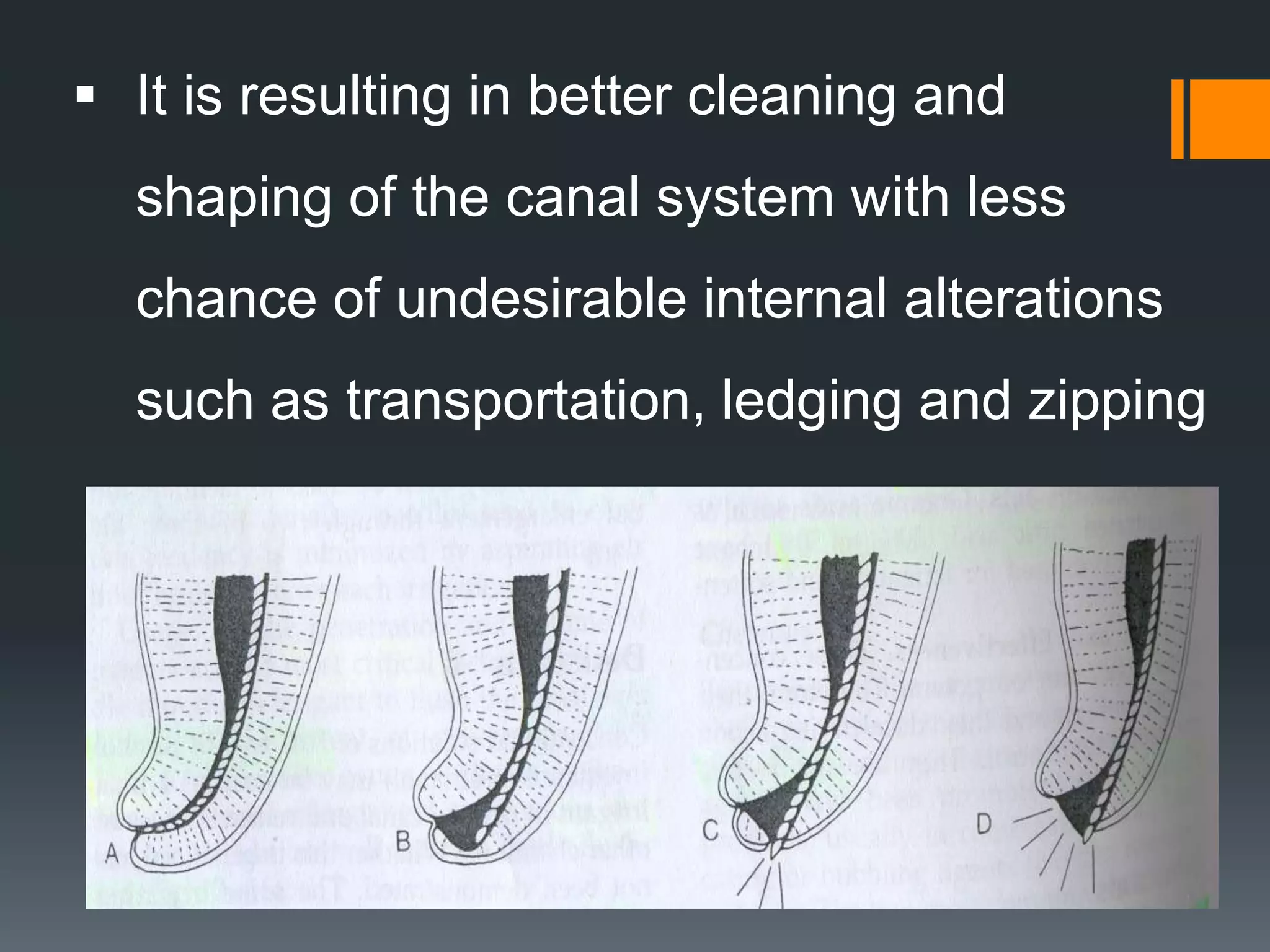 Access Cavity Prepration | PPTX