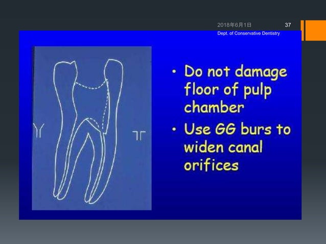 Access Cavity Prepration | PPTX