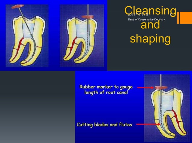 Access Cavity Prepration | PPTX