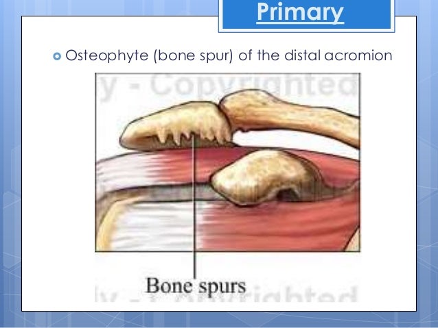 Shoulder Pathology and the Industrial Athlete