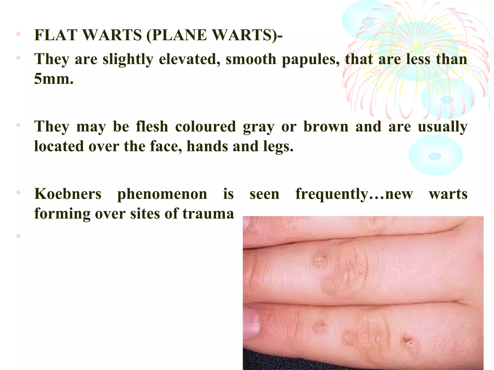 Ksharodhaka injection....treatment of warts...charmakila | PPT