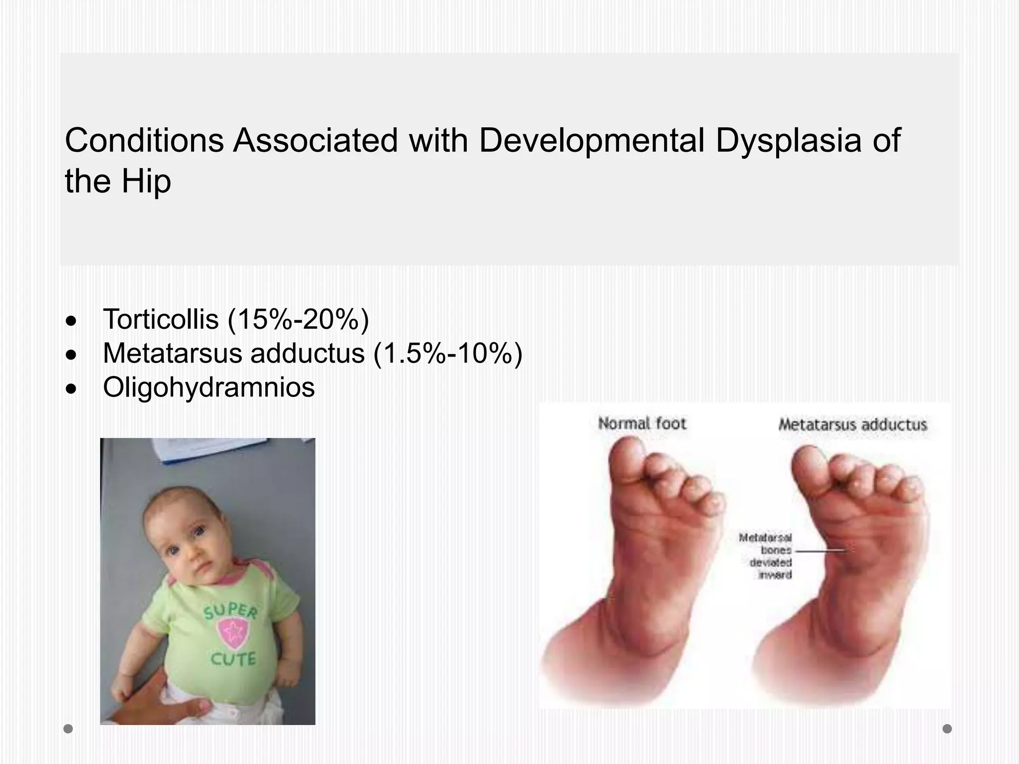 Developmental dysplasia of hip | PPTX