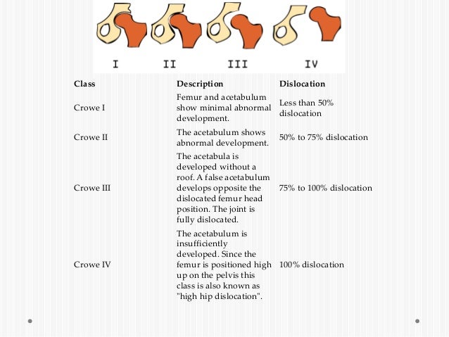 Developmental dysplasia of hip