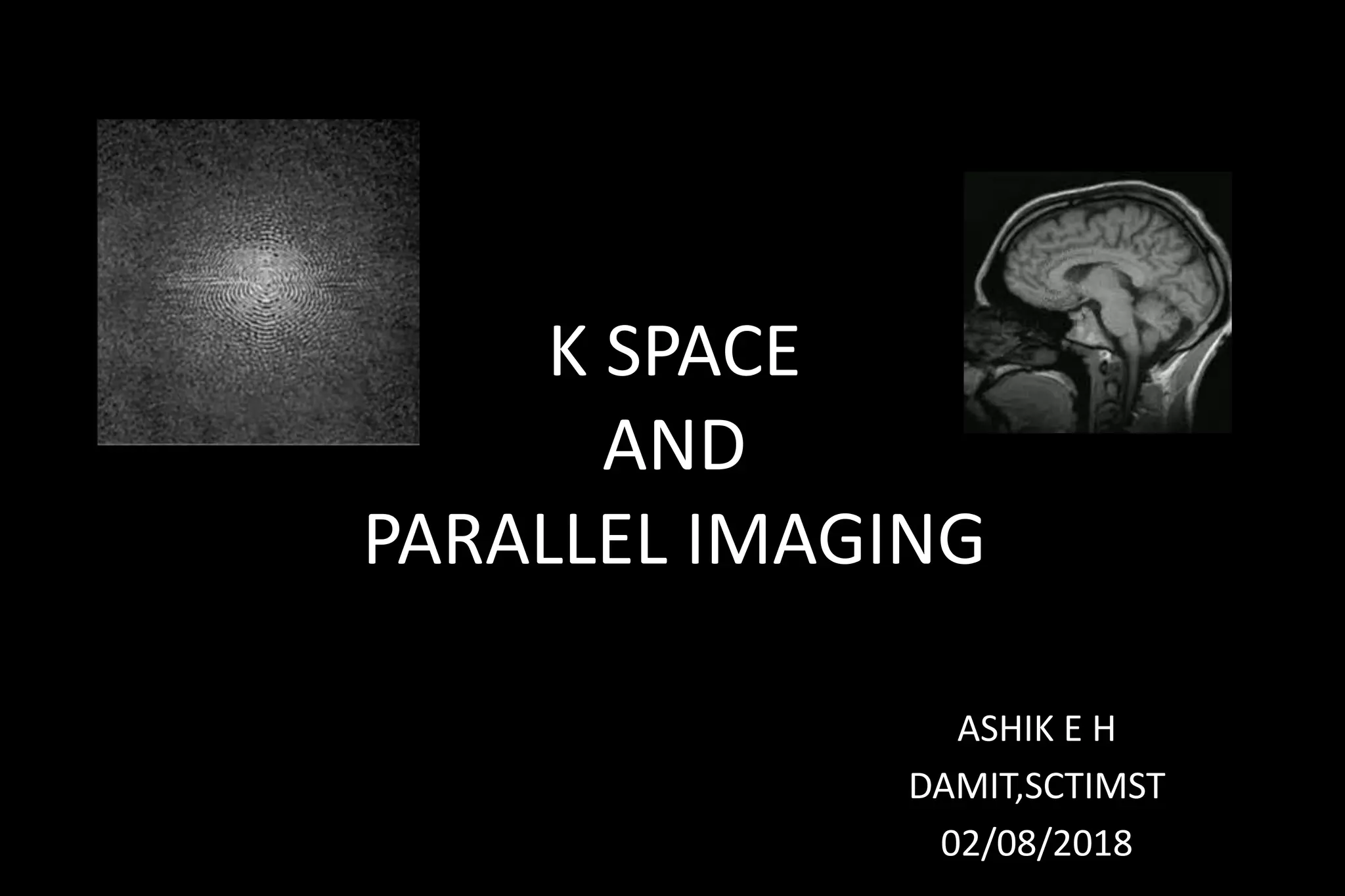 K space and parallel imaging | PPTX | Medical Tests | Medical Health