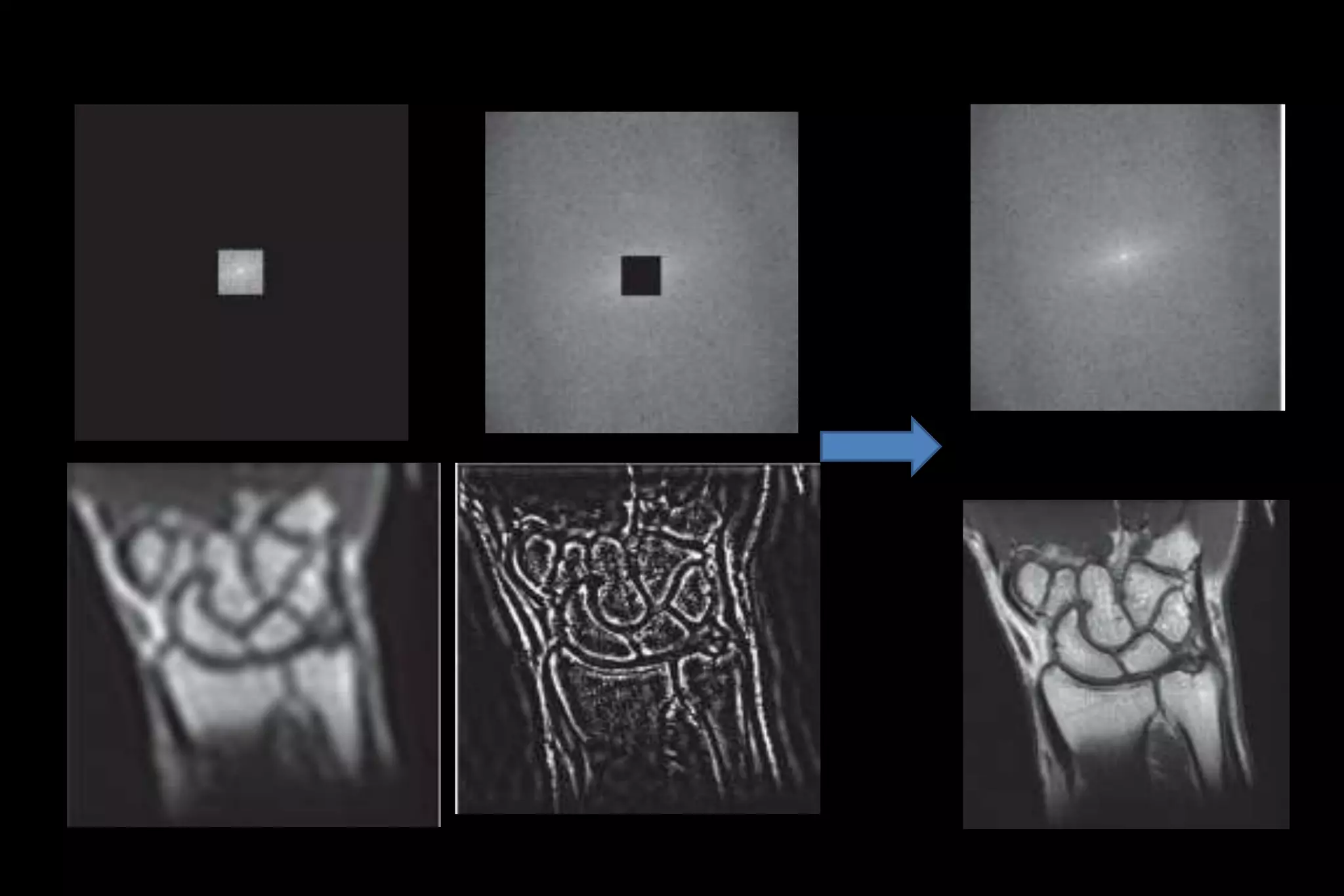 K space and parallel imaging | PPTX | Medical Tests | Medical Health