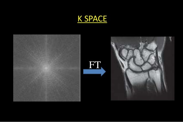 K space and parallel imaging