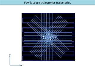 Introduction to k-space trajectories | PDF