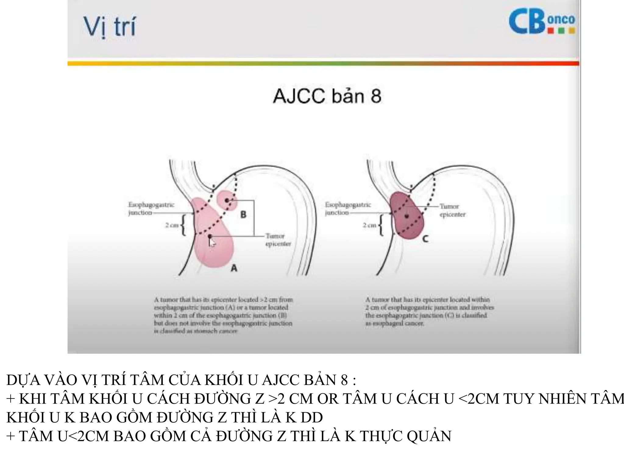 K THỰC QUẢN adult cap nhat chuan doan va dieu tri.pptx