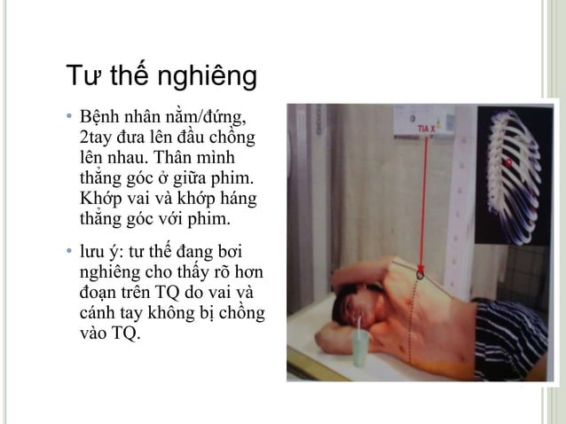 Kĩ thuật chụp x quang nâng cao thực quản | PPTX