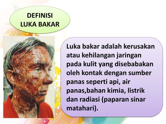 pengobatan luka bakar | PPTX