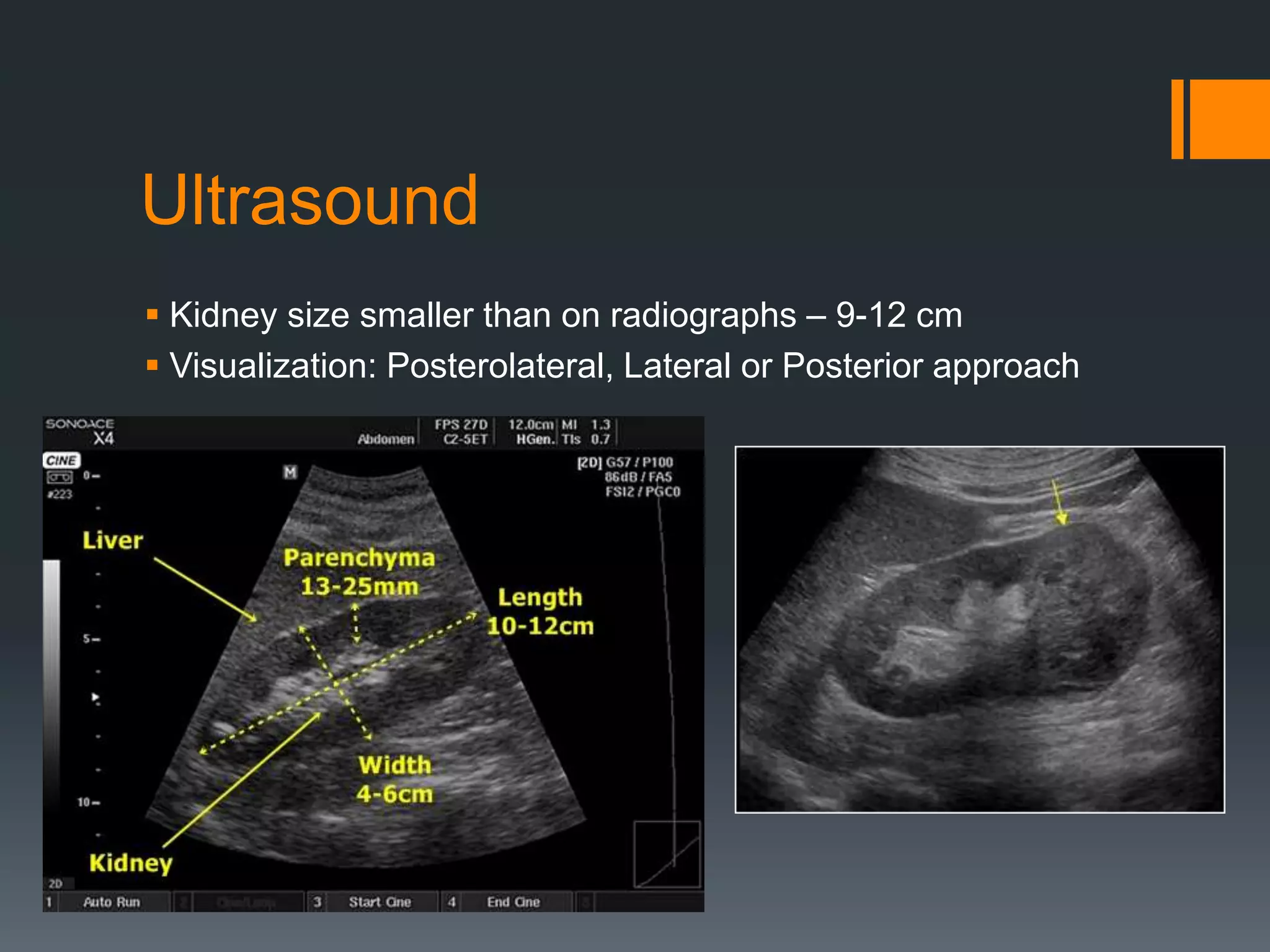 Kub - xray and usg | PPTX