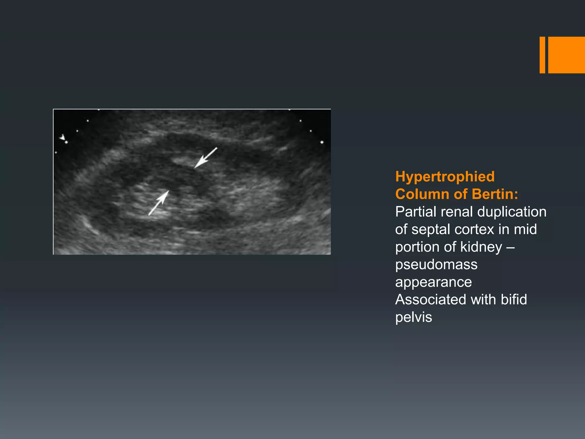 Kub - xray and usg | PPTX