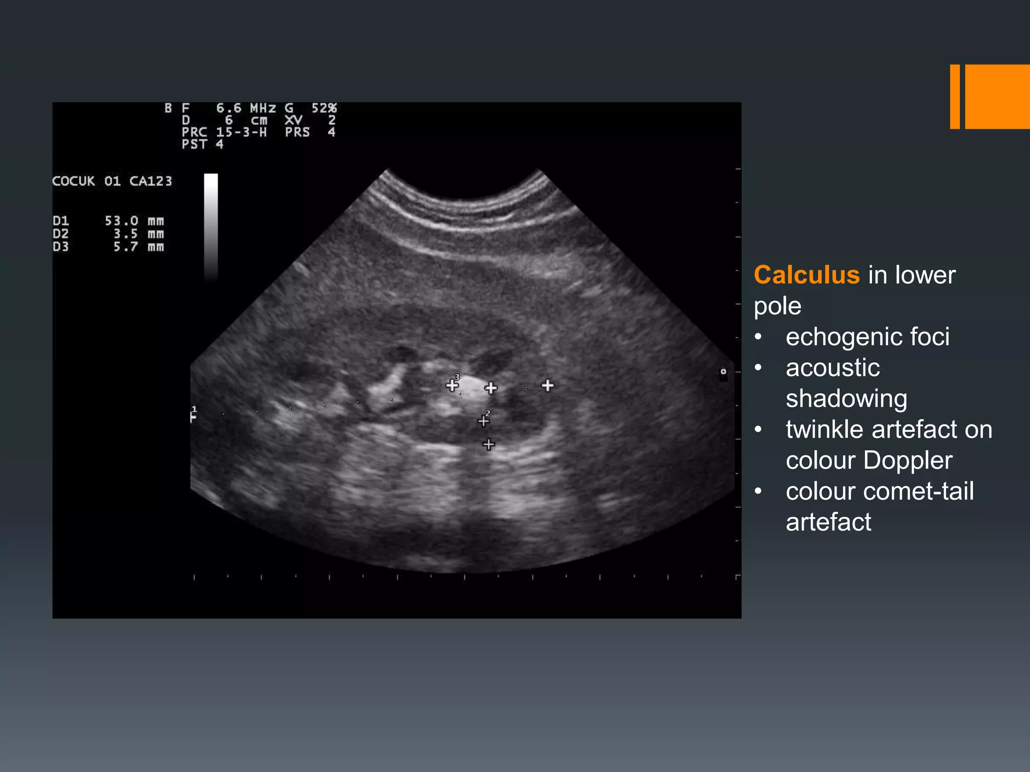 Kub - xray and usg | PPTX