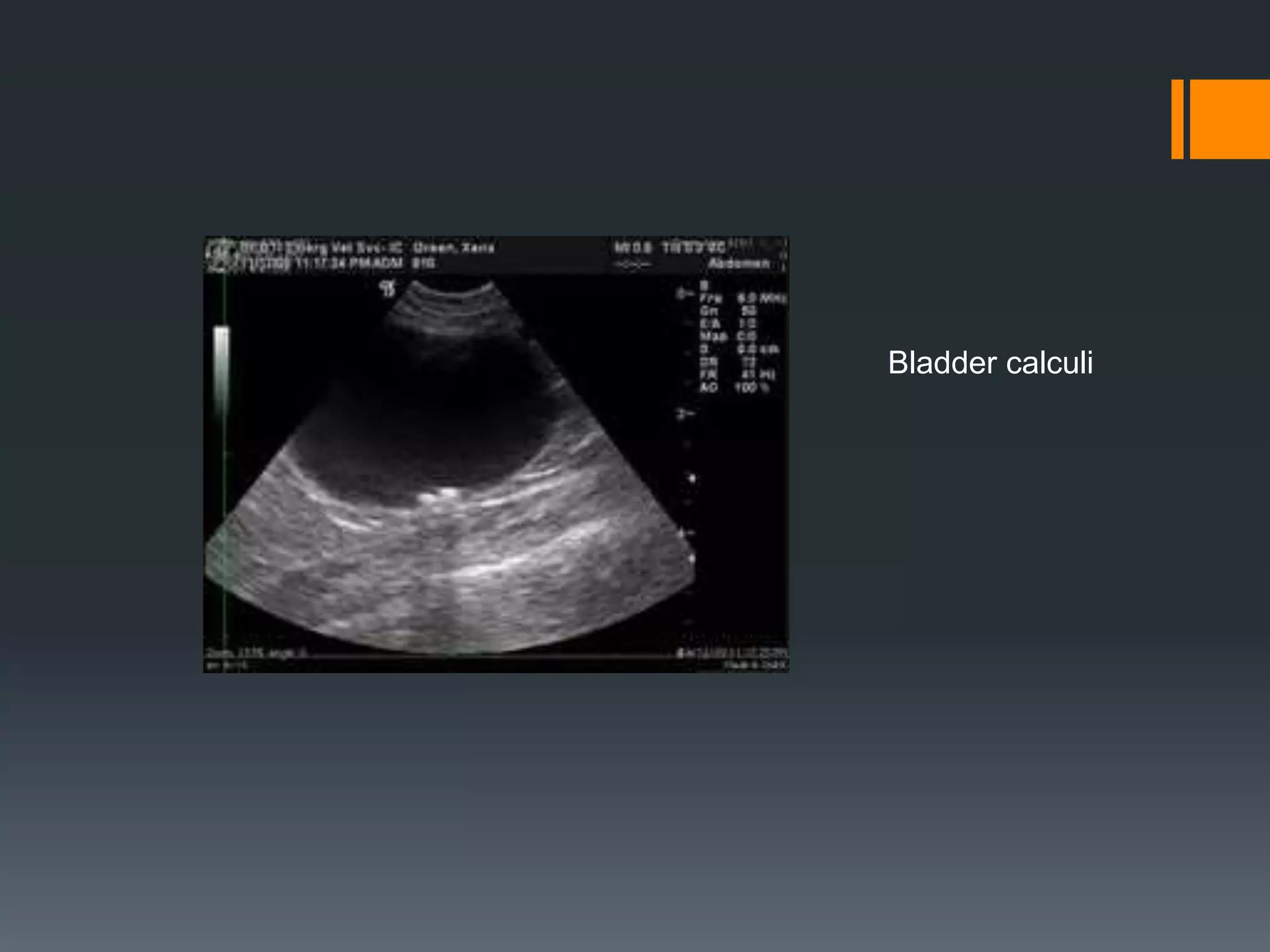 Kub - xray and usg | PPTX