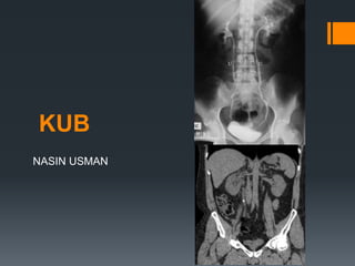 Kub - xray and usg | PPTX
