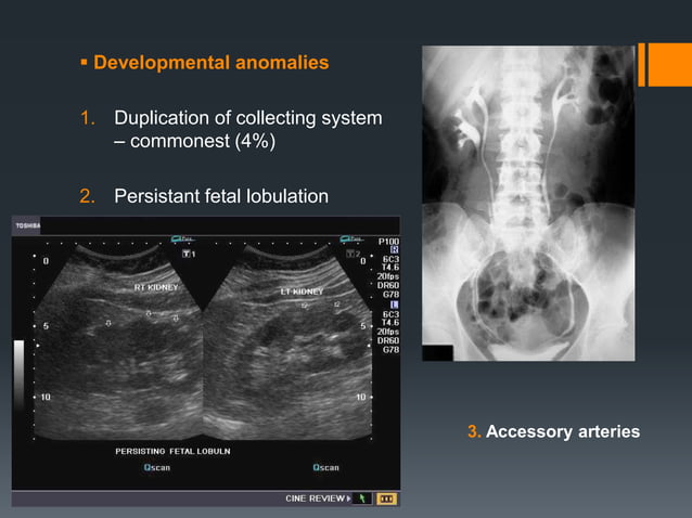Kub - xray and usg | PPTX
