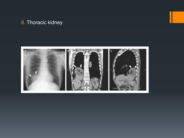 Kub - xray and usg | PPTX