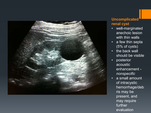 Kub - xray and usg | PPTX