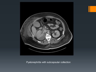 Kub - xray and usg | PPTX
