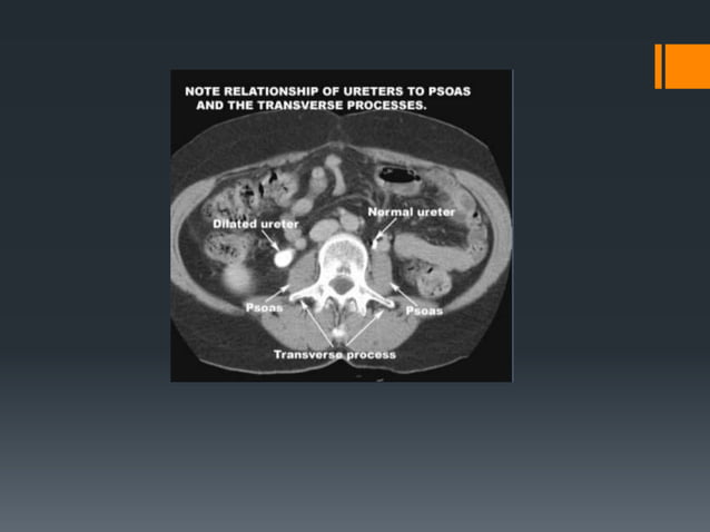 Kub - xray and usg | PPTX