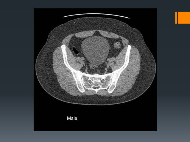 Kub - xray and usg | PPTX