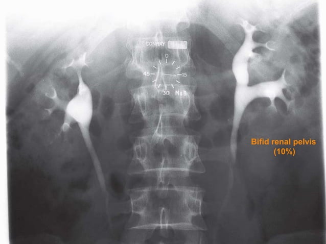 Kub - xray and usg | PPTX