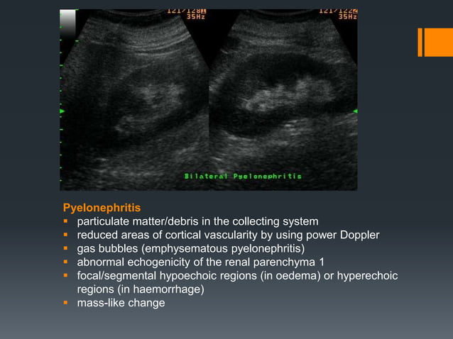 Kub - xray and usg | PPT