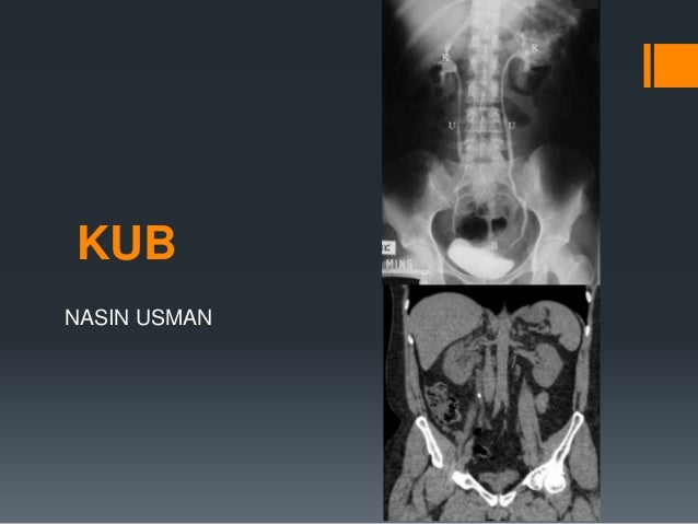 Kub - xray and usg