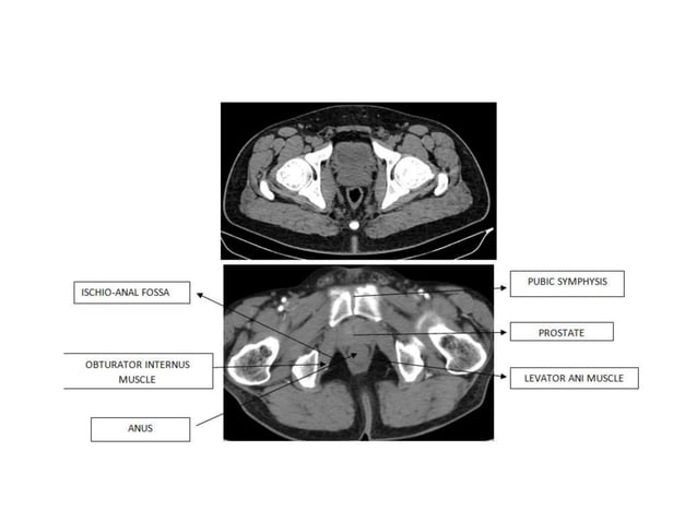 Kub anatomy | PPTX | Medical Health