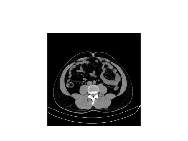 Kub anatomy | PPTX | Medical Health