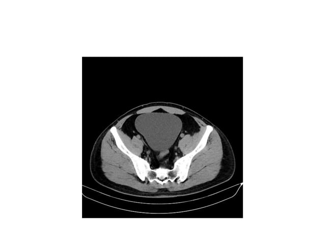 Kub anatomy | PPTX | Medical Health