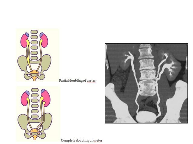 Kub anatomy | PPTX | Medical Health