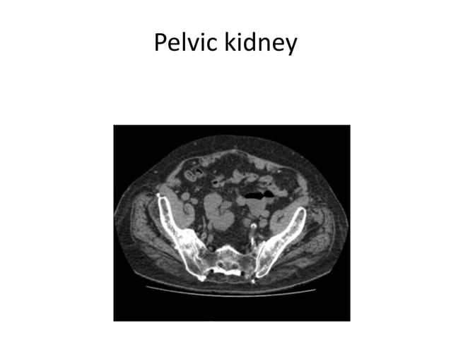 Kub anatomy | PPTX | Medical Health