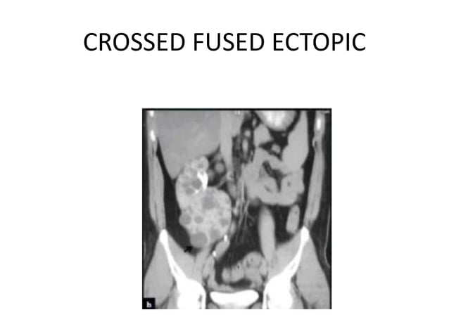 Kub anatomy | PPTX | Medical Health