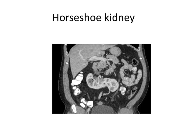Kub anatomy | PPTX | Medical Health